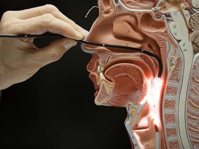 FEES | Sydney Swallowing Diagnostics